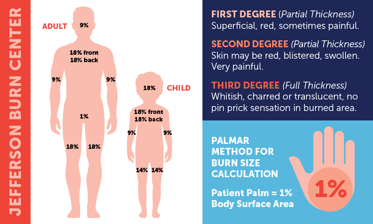 Burn Care | Jefferson Health