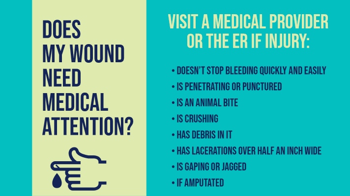 Ouch! Do I Need Stitches for This Cut? | Jefferson Health