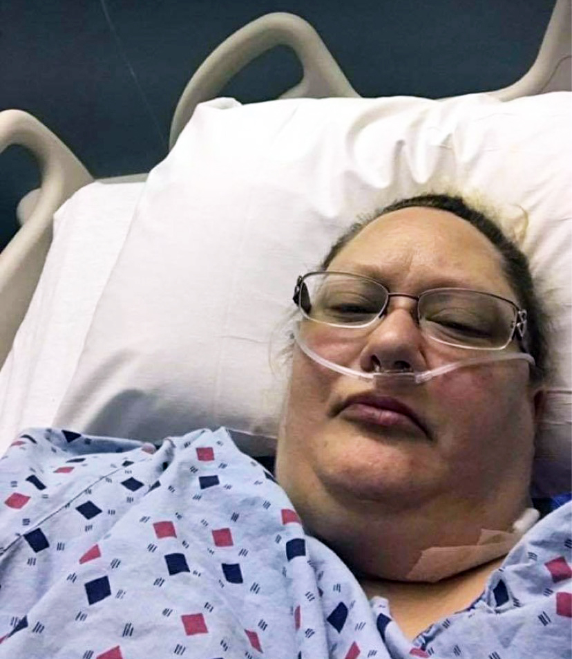 A Bariatric Success Story: Lisa Sacco’s Commitment and Follow-Up Helps ...