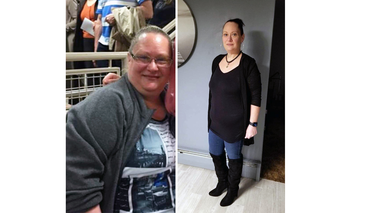 A Bariatric Success Story: Lisa Sacco’s Commitment and Follow-Up Helps ...