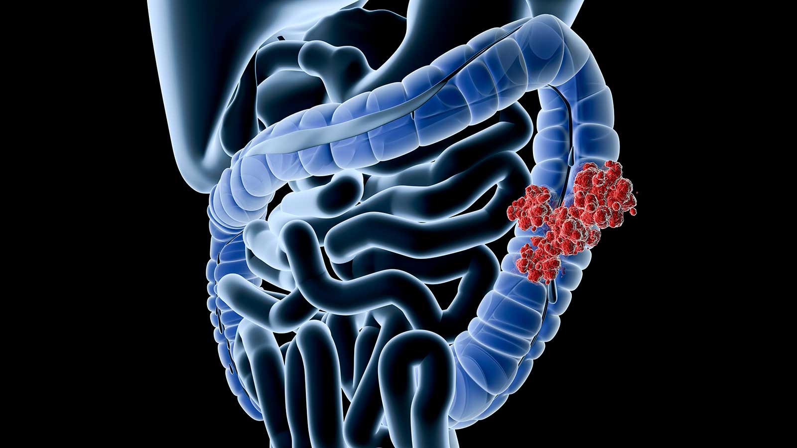 Colonoscopy | Jefferson Health