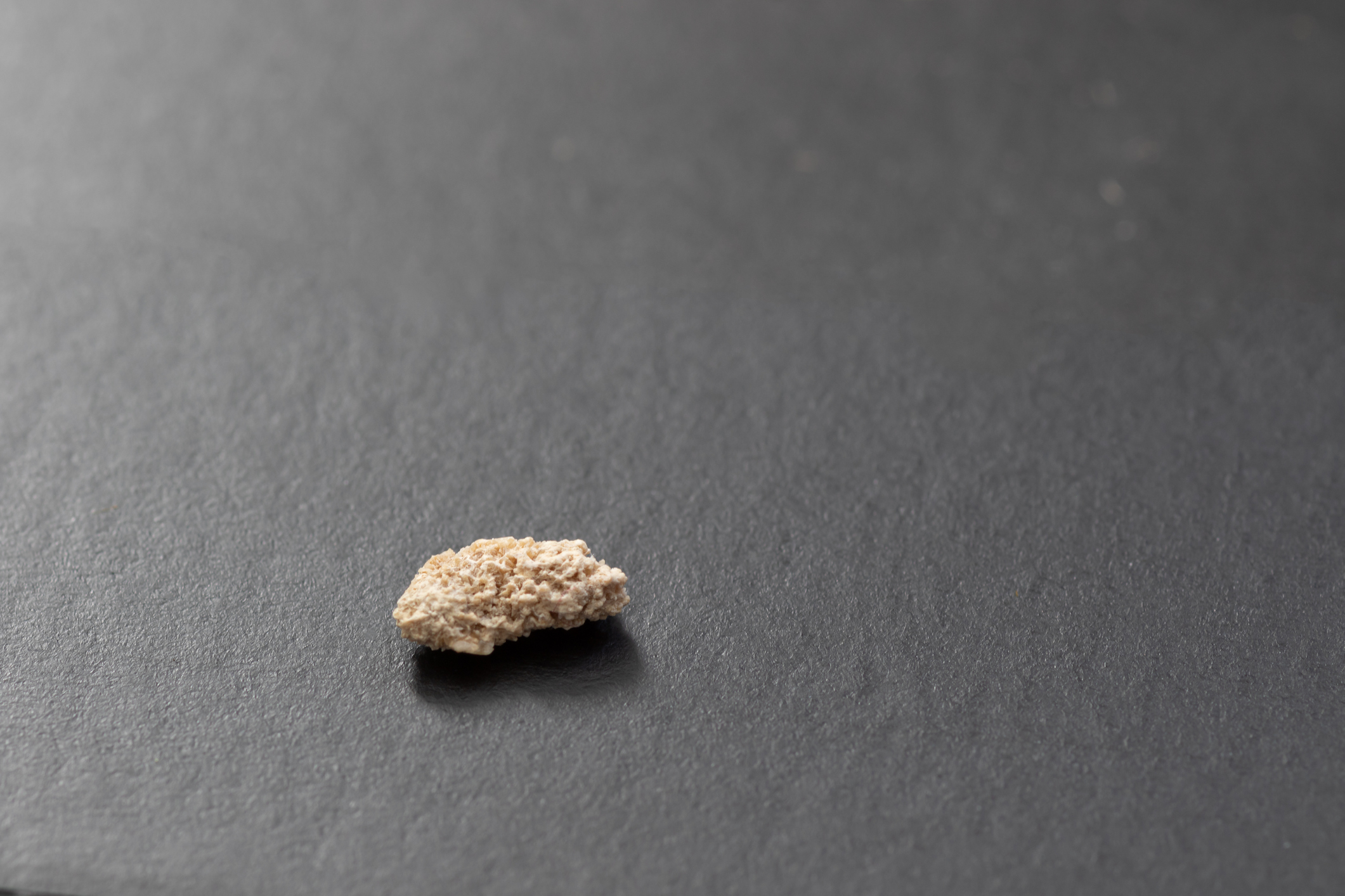 Q A Can You Prevent Kidney Stones Jefferson Health Q A Can You Prevent Kidney Stones Jefferson Health