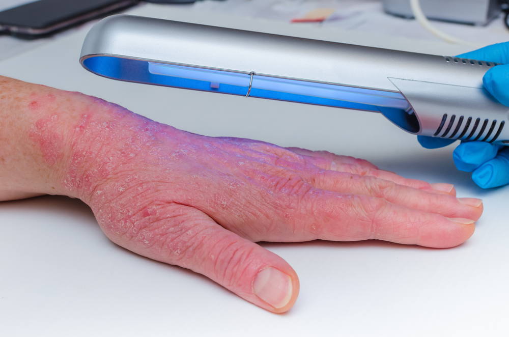 Dermatology | Jefferson Health
