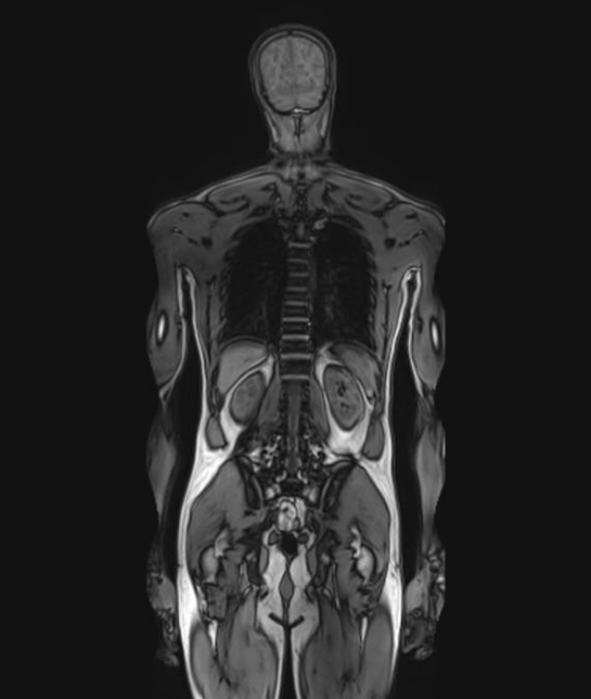 Marcus Institute of Integrative Health - Imaging Services | Jefferson ...