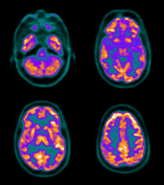 Pet Brain Pet Brain