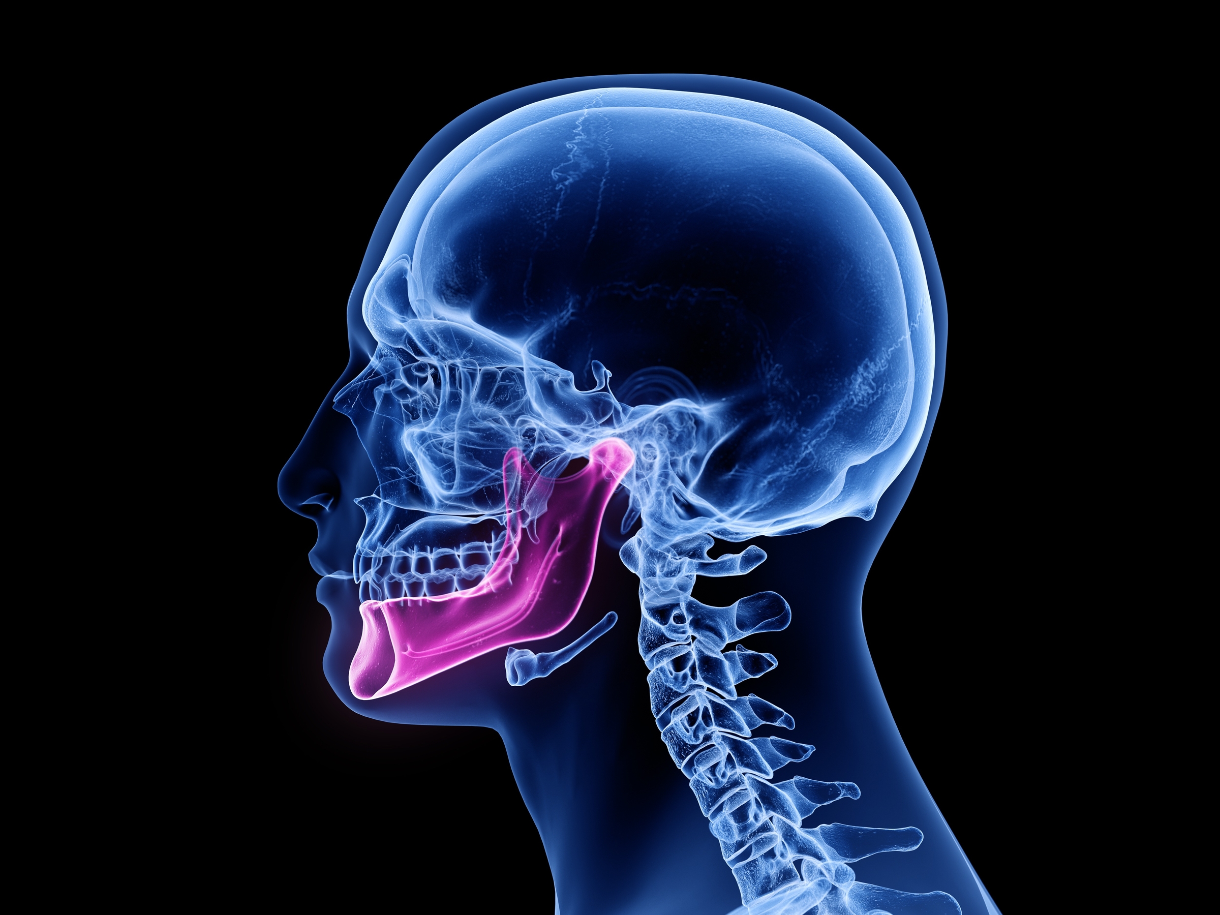 Maxillomandibular Advancement (MMA) | Jefferson Health