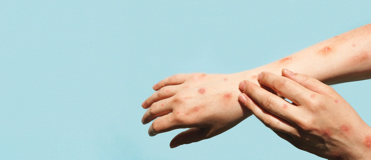 What Is Metabolism? How It Works and Relates to Weight Loss | Jefferson ...