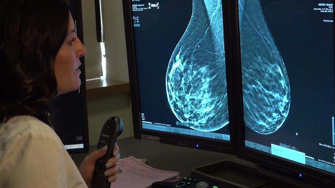 Mammogram | Jefferson Health
